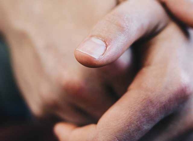 NGOs mark one year since activation of the Temporary Protection ...